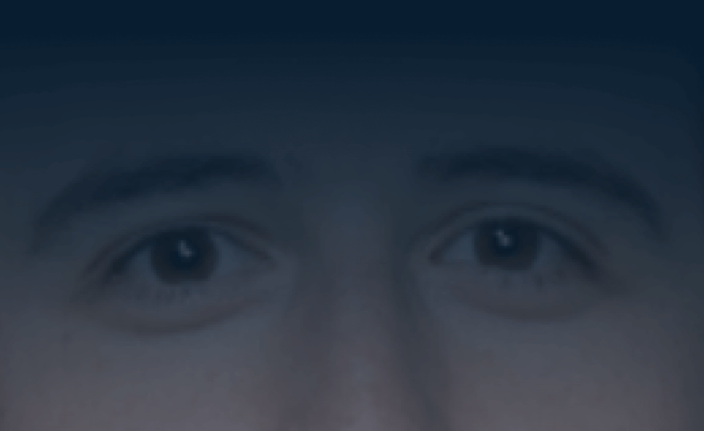 Home | XDEMVY® (lotilaner ophthalmic solution) 0.25%